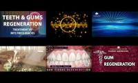multi gums and teeth2 - Youtube Multiplier